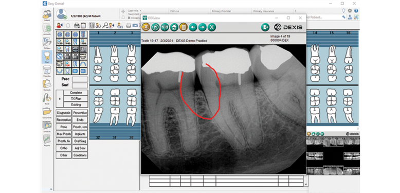 Software DEXIS™ Imaging Suite | DEXIS