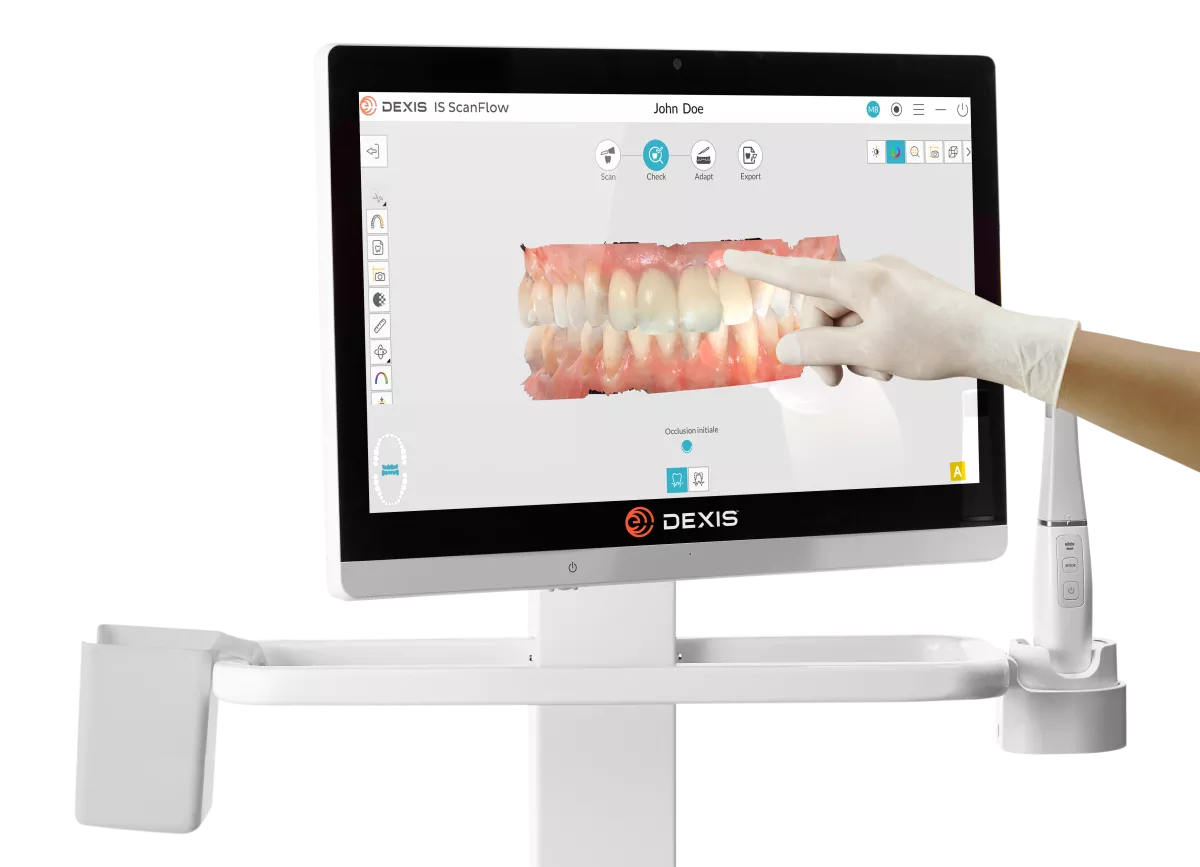 How dental hygienists are fitting intraoral scans into their (already ...