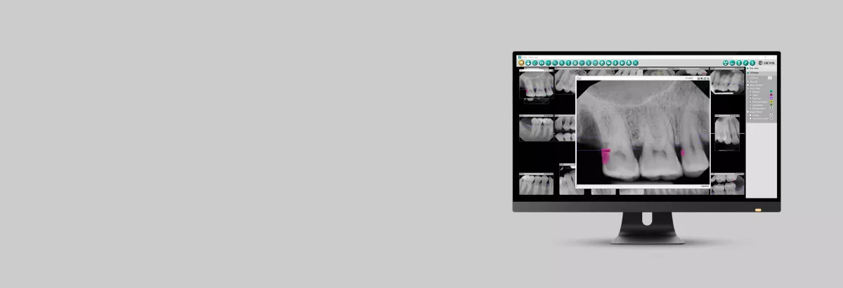 Welcome to DEXIS™ - Dental Imaging Solutions