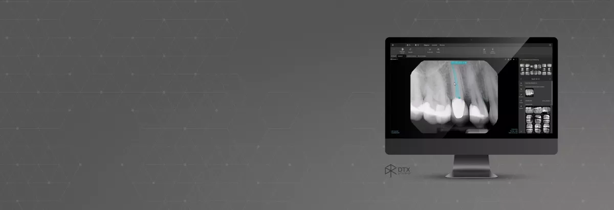 DTXassist Early Access | DEXIS